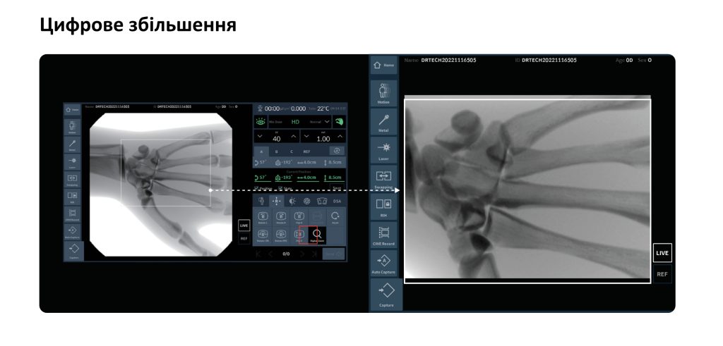X-ray fluoroscopic system EXTRON 7, (C-Arm) produced by DRTECH Corp ...