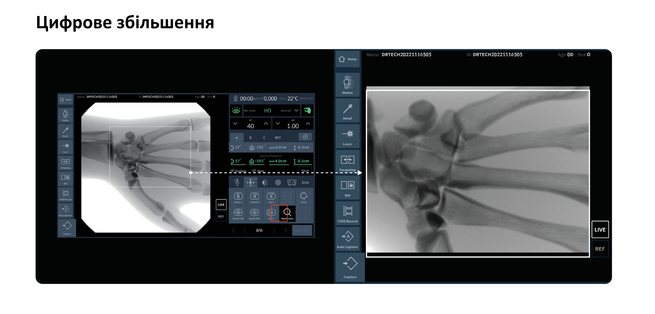 X-ray fluoroscopic system EXTRON 7, (C-Arm) produced by DRTECH Corp ...